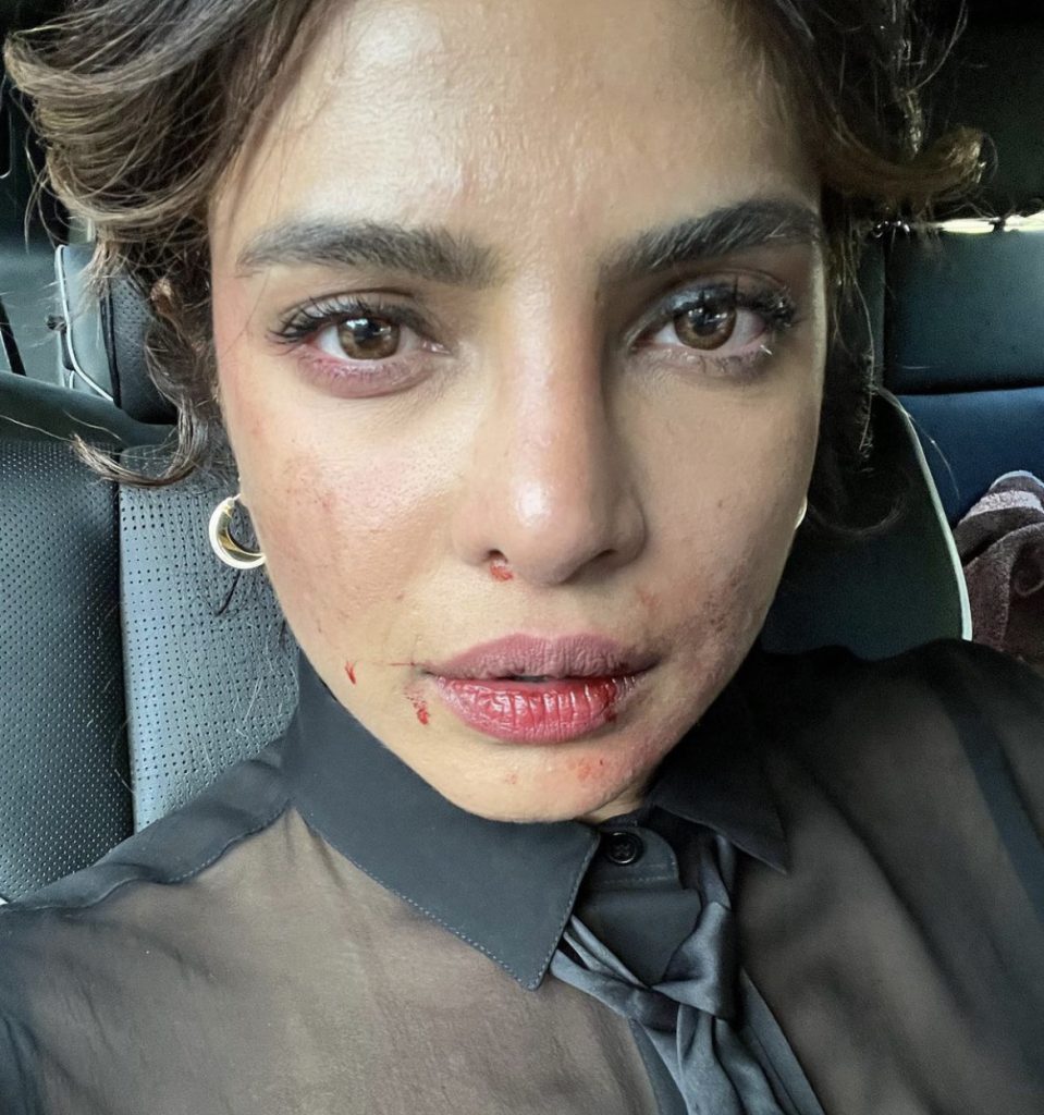 Avika Gor aka Anandi of 'Balika Vadhu' is becoming bold, flaunted her ...